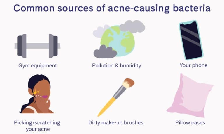 Acne or Bacterial Infection? Understanding the Differences and ...